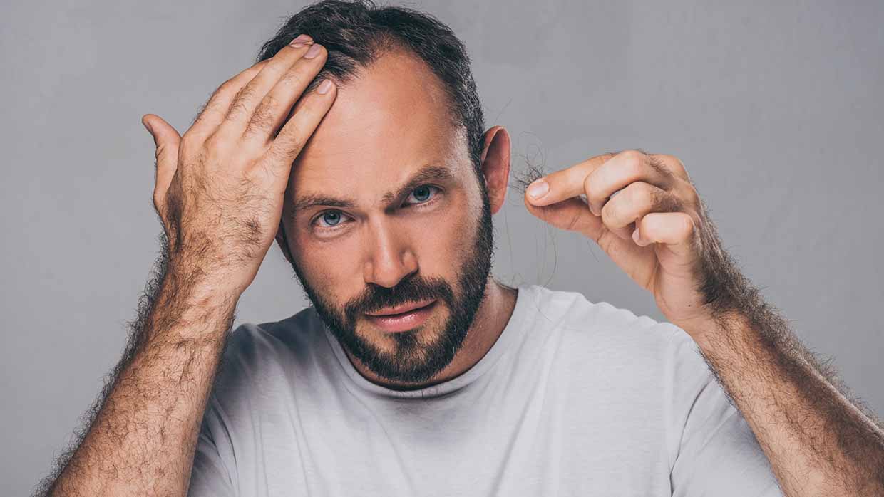 Capire la caduta dei capelli negli uomini: cause, ereditarietà e cosa ...